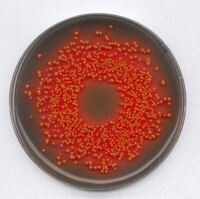Hektoen Enteric Agar Positive Result